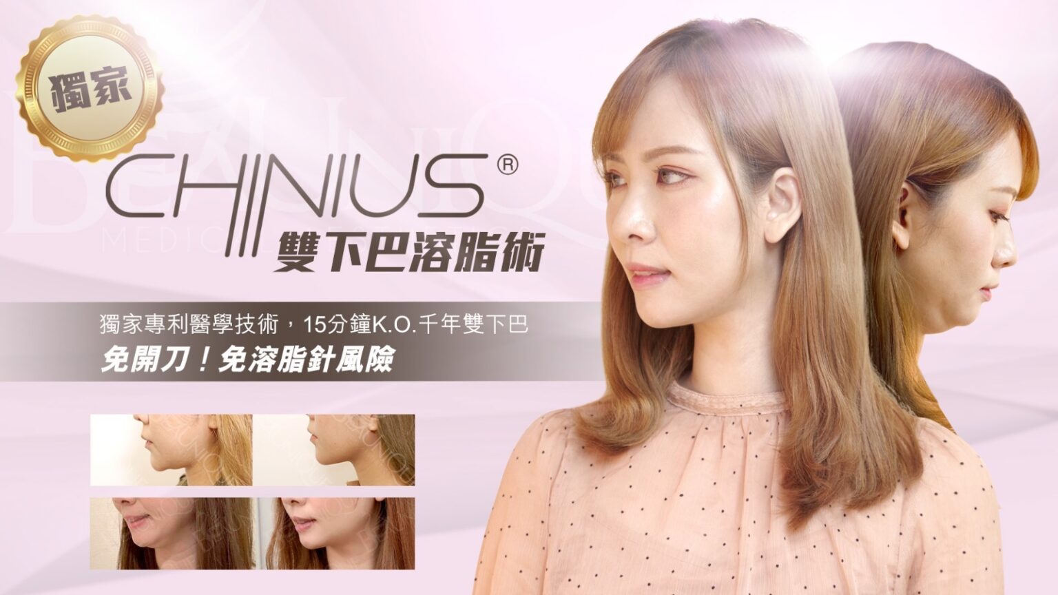Chinius 雙下巴溶脂術｜非手術非針劑｜Beaunique獨家主理